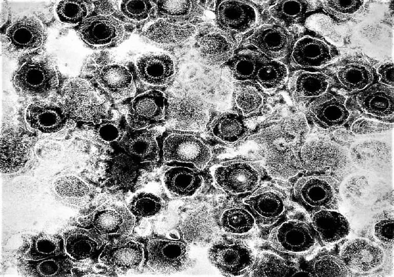 HERPES SIMPLEX VIRUS (HSV TYPE 1 & 2) | VIROLOGY NOTES
