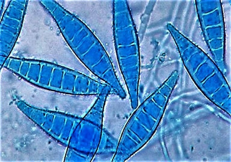 Superficial Mycoses - Infection of Skin, Hair & Nails | Mycology Notes