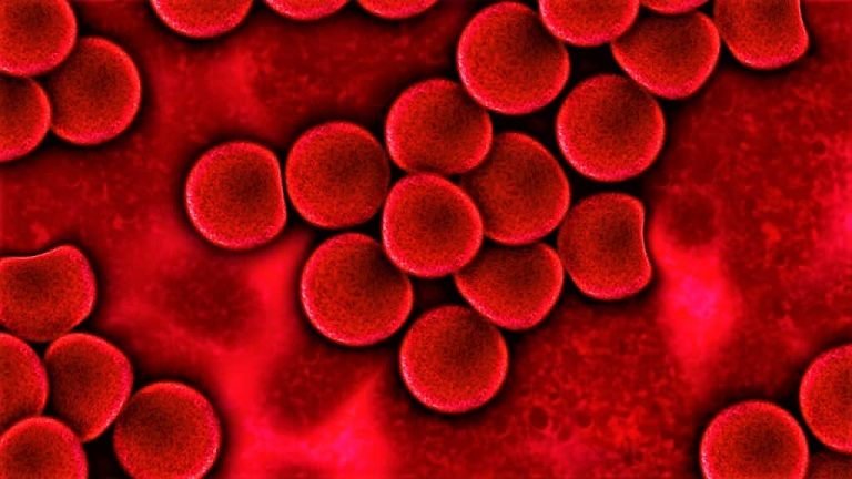 Red Cell Indices - MCV, MCH & MCHC | Hematology Notes