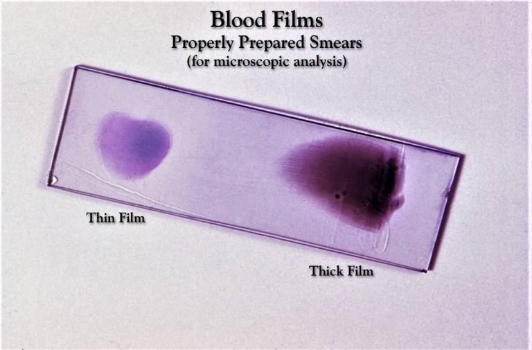 Giemsa Staining Technique - Principle, Preparation, Procedure & Results