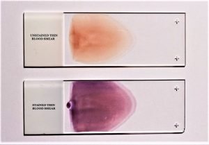 Giemsa Staining Technique - Principle, Preparation, Procedure & Results