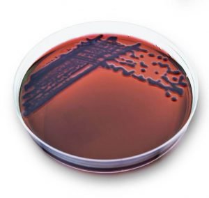 Morphology & Culture Characteristics of Klebsiella pneumoniae