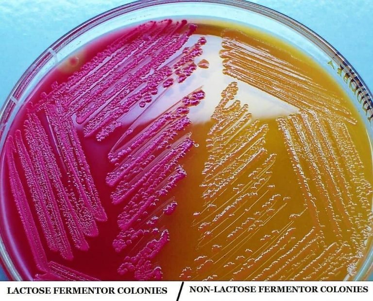 Composition of MacConkey Agar Medium | Microbiology Practicals