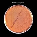 Morphology & Culture Characteristics of Proteus Vulgaris