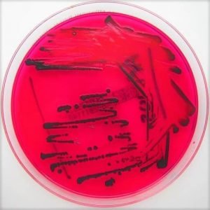 Morphology & Culture Characteristics of Salmonella typhi (S. typhi)