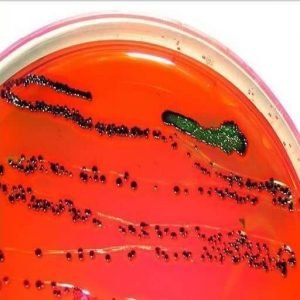 Morphology & Culture Characteristics of Escherichia coli (E. coli)