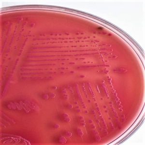 Morphology & Culture Characteristics of Escherichia coli (E. coli)