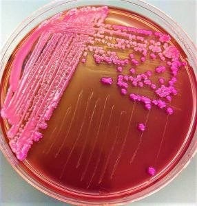 Biochemical Tests for Klebsiella pneumoniae | Bacteriology Notes