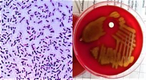 Morphology & Culture Characteristics of Streptococcus pneumoniae