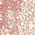 Morphology & Culture Characteristics of Pseudomonas aeruginosa