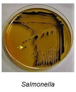 Morphology & Culture Characteristics of Salmonella typhi (S. typhi)