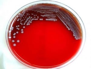 Morphology & Culture Characteristics of Yersinia pestis