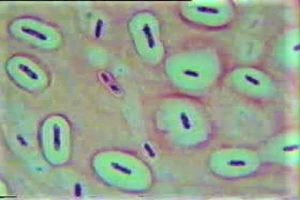Capsule Staining - Principle, Methods, Procedure & Result Interpretation