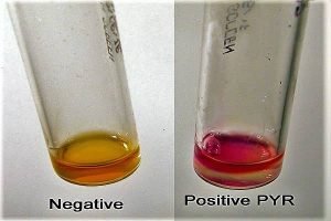 Biochemical Tests for Streptococcus pyogenes | Bacteriology Notes