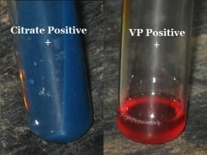 Biochemical Tests for Klebsiella pneumoniae | Bacteriology Notes
