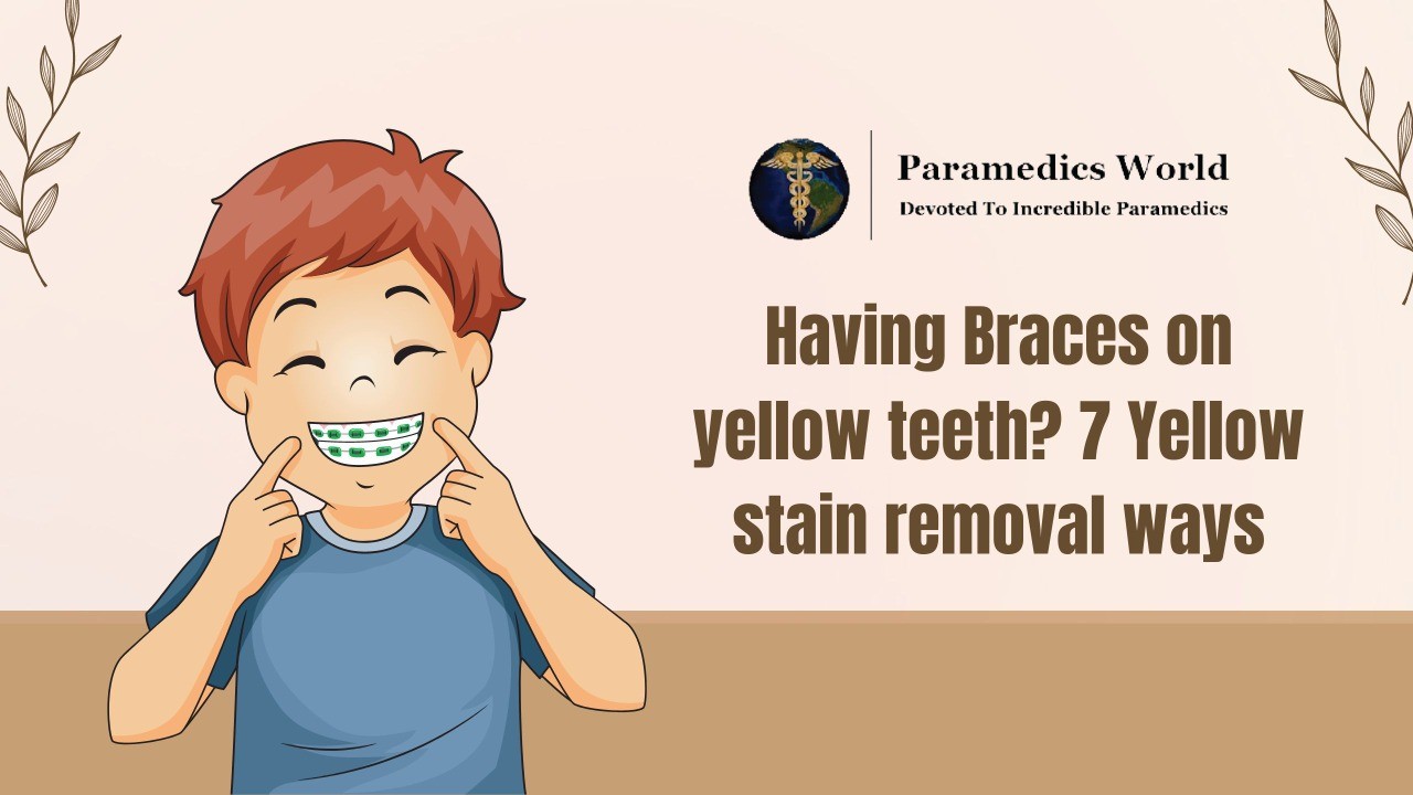 Having Braces on Yellow Teeth? 7 Yellow Stain Removal Ways