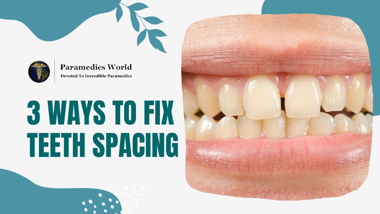 3 Ways to Fix Teeth Spacing - Paramedics World
