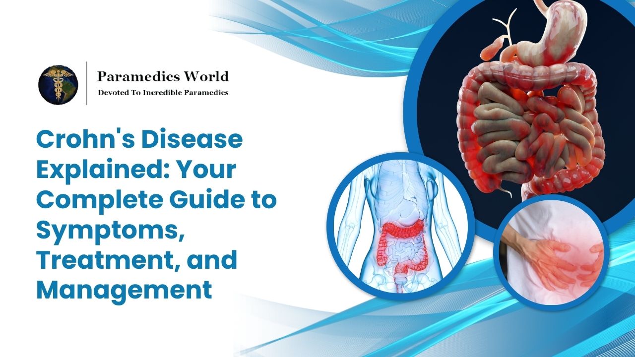 Crohn's Disease Explained: Your Complete Guide to Symptoms, Treatment ...