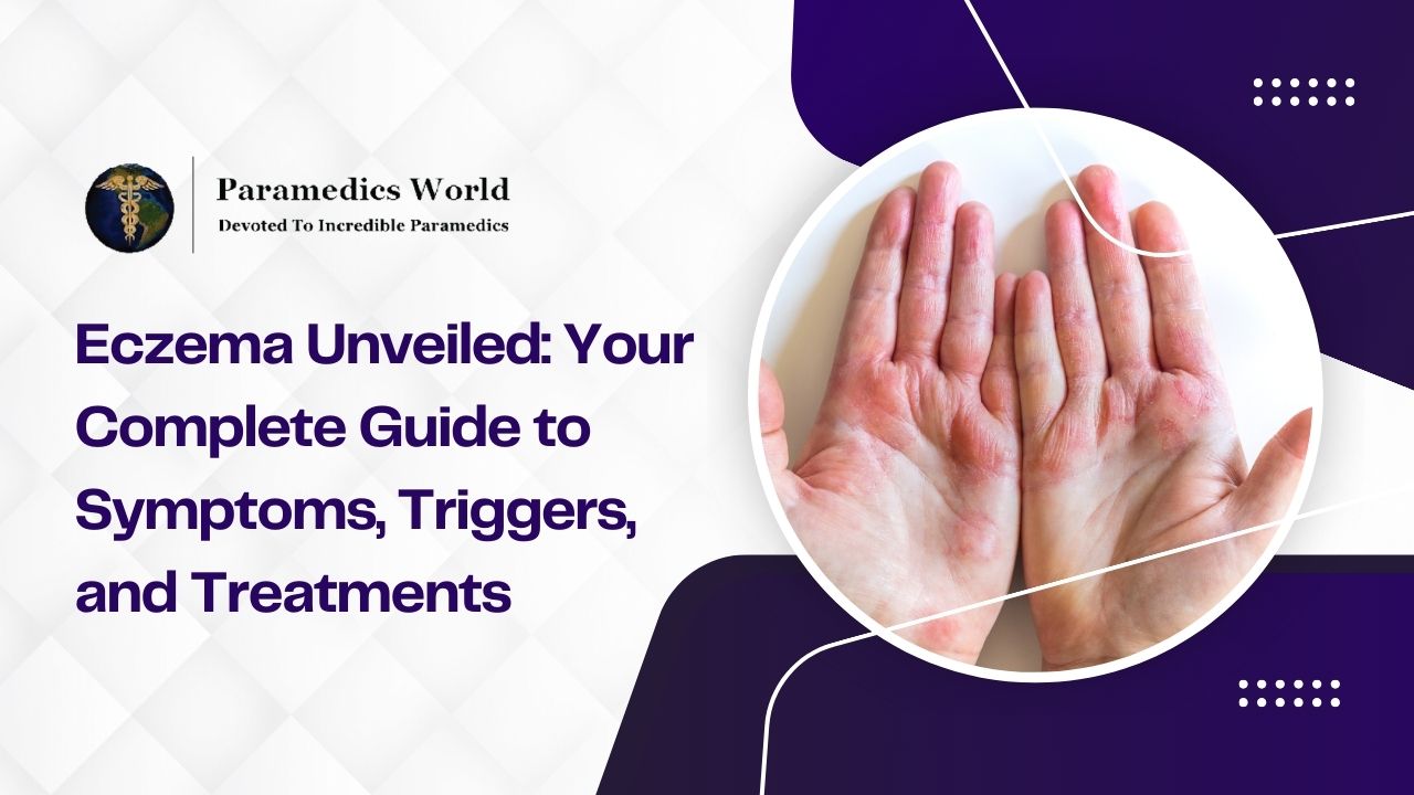 Eczema Unveiled: Your Complete Guide to Symptoms, Triggers, and Treatments
