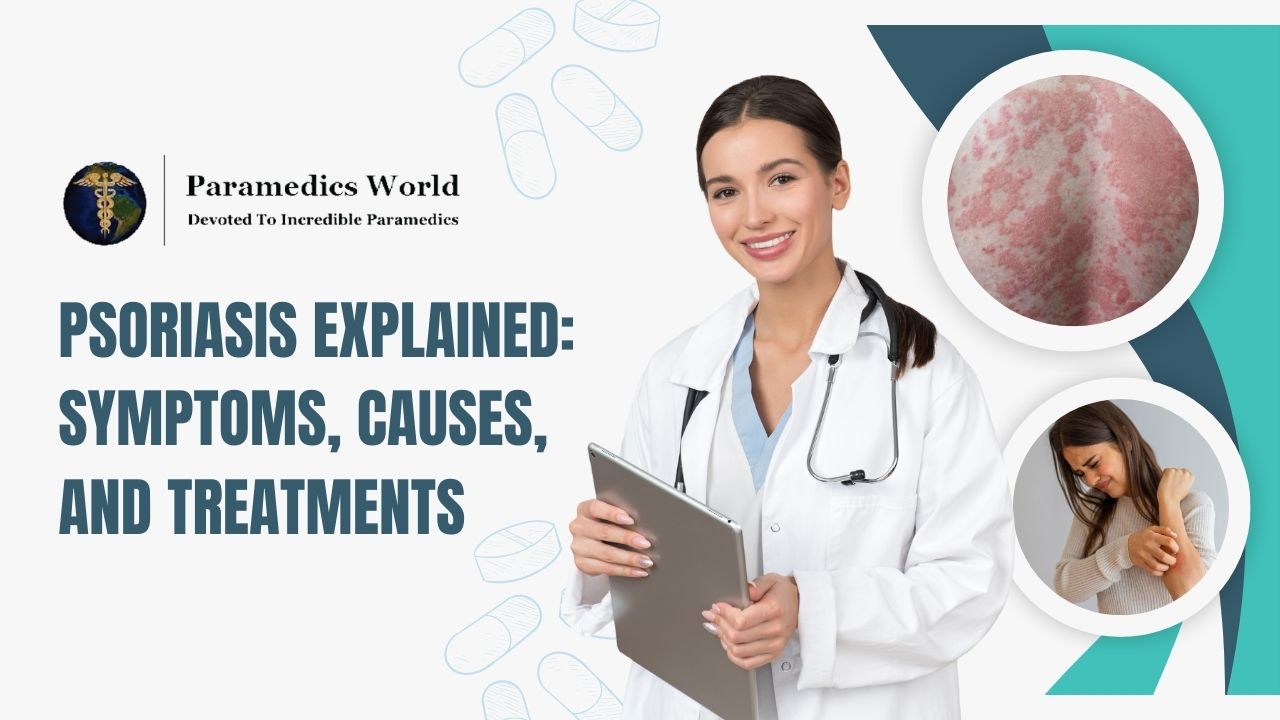 Psoriasis Explained: Symptoms, Causes, and Treatments
