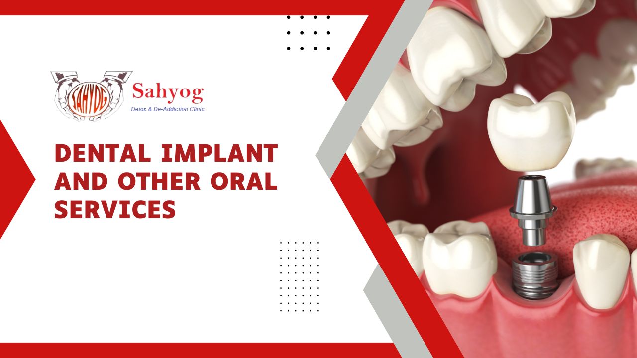 Dental Implant and other oral services