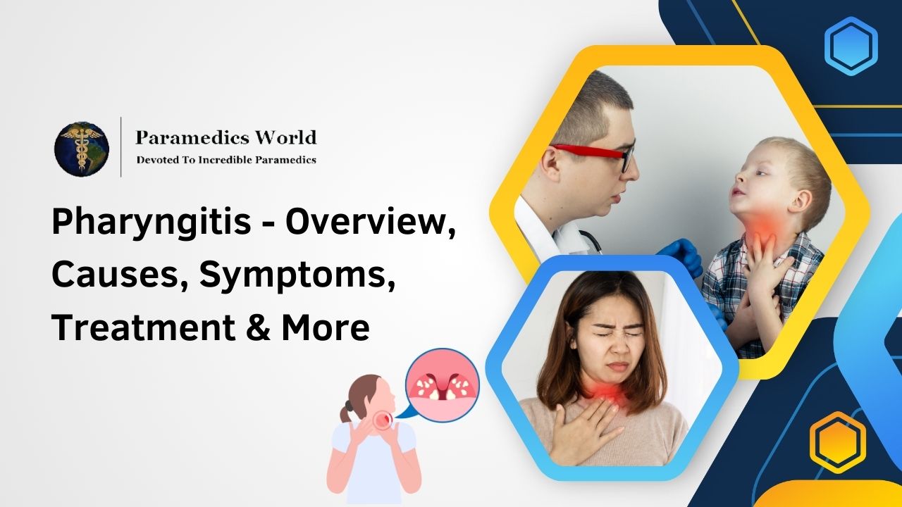 Pharyngitis - Overview, Causes, Symptoms, Treatment & More