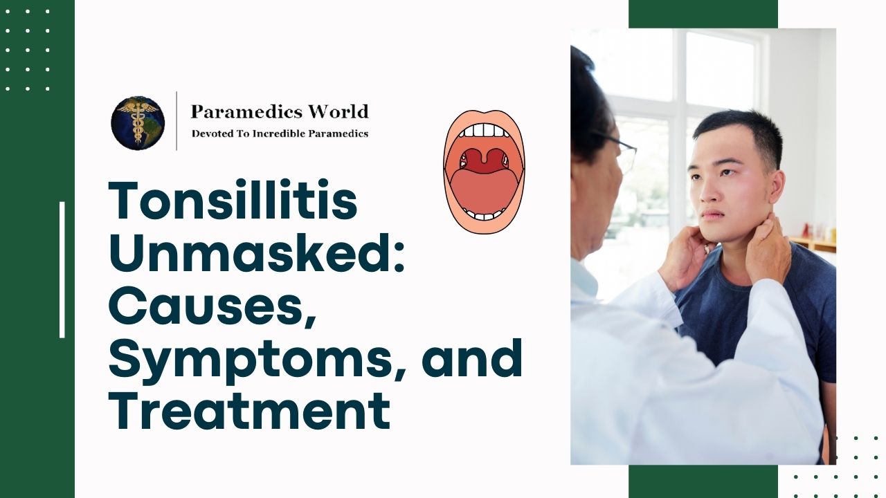 Tonsillitis Unmasked: Causes, Symptoms, and Treatment