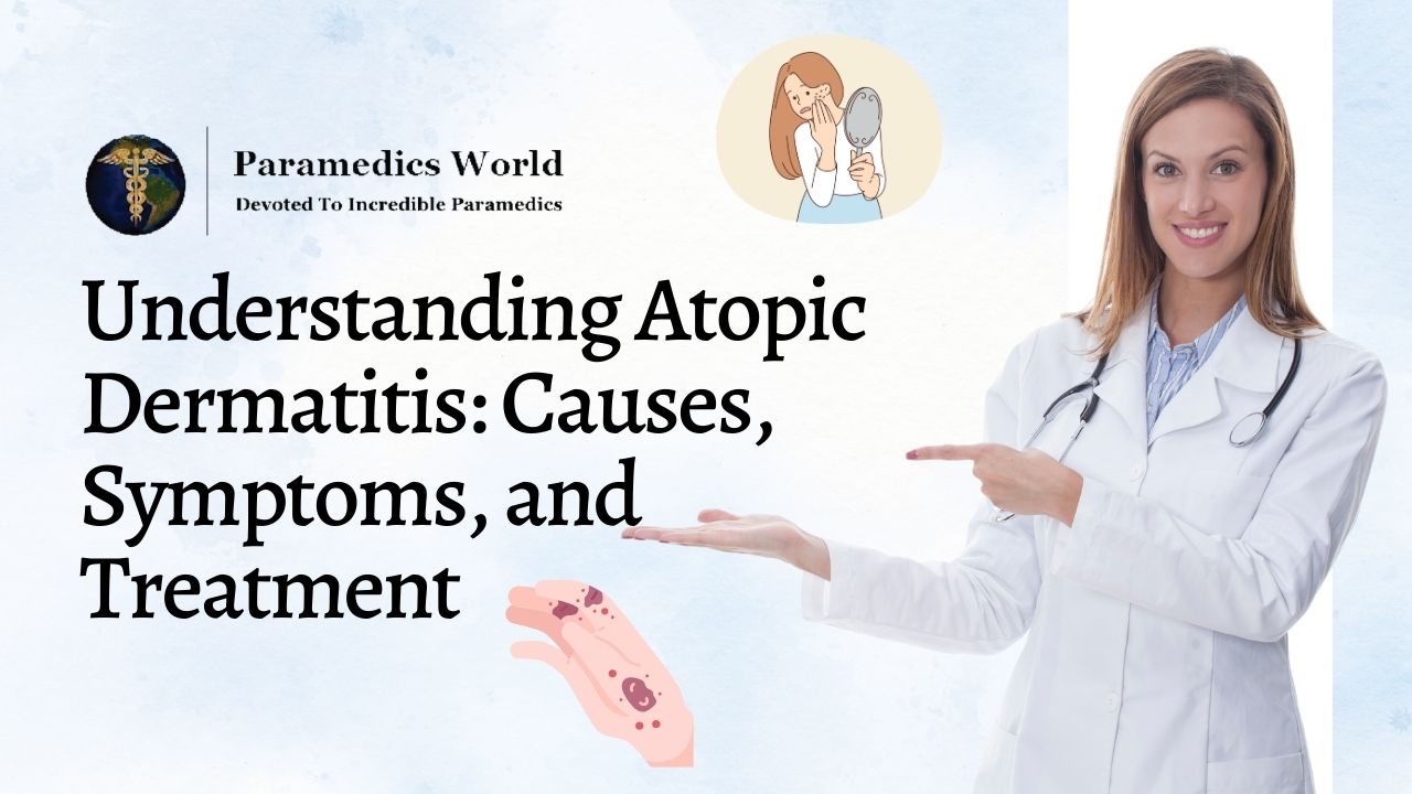 Understanding Atopic Dermatitis: Causes, Symptoms, and Treatment
